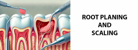 The Root Planing and Scaling Guide Including Costs