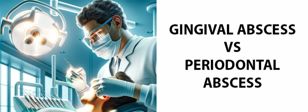 The Gingival Abscess vs Periodontal Abscess Guide