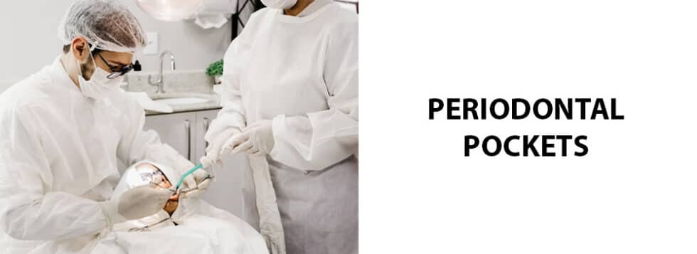 The Periodontal Pockets Guide: Depths & Treatments