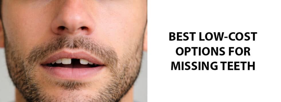 Low-Cost Options For Missing Teeth: What Options Are Best